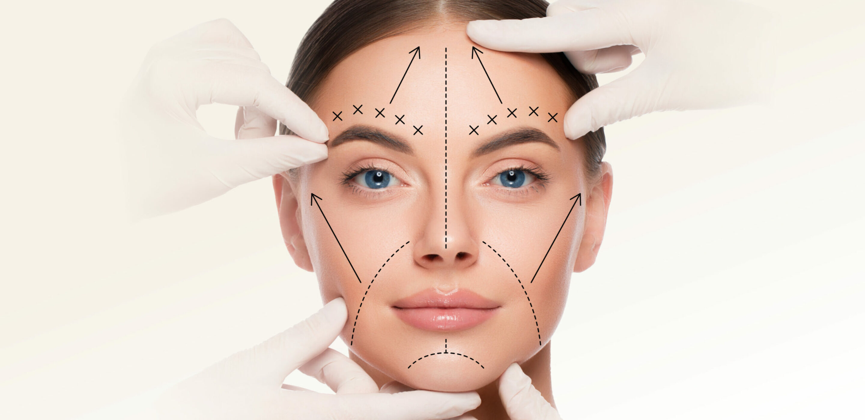 Deep Plane Facelift - YES VISAGE